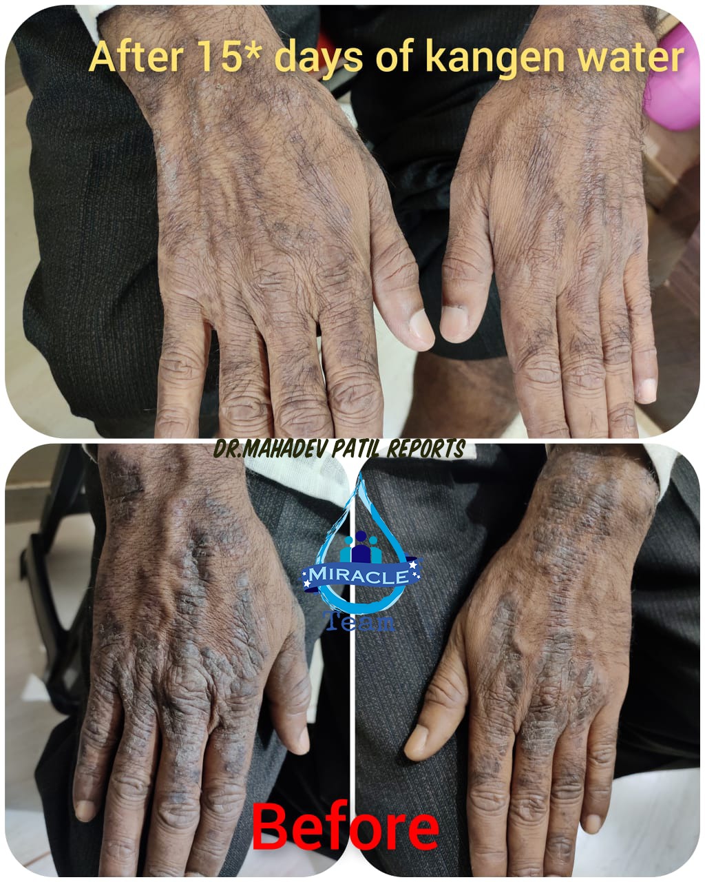 Kangen Miracle Water