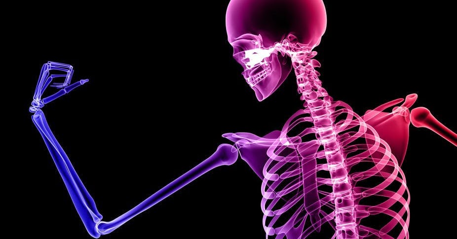 Amalina Nudin: ORTHOPAEDIC WARD WORK