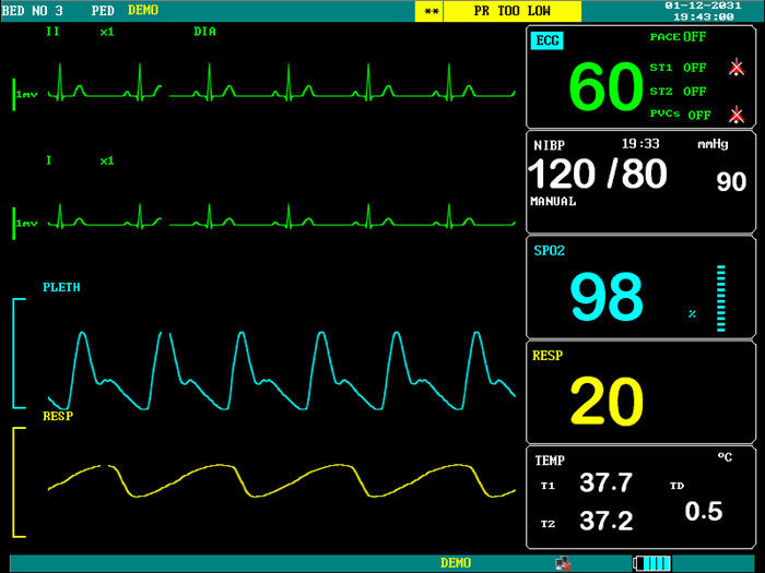 Multiparameter Health Monitor For Physiological Signals