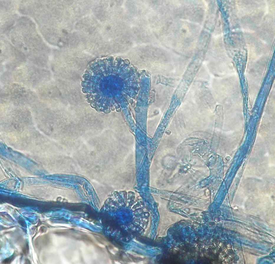 ATLAS MICOLOGIA: SYNCEPHALASTRUM RACEMOSUM