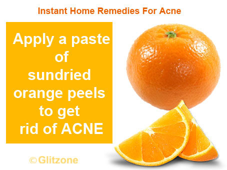 Glitzone: Instant Home Remedies For Acne