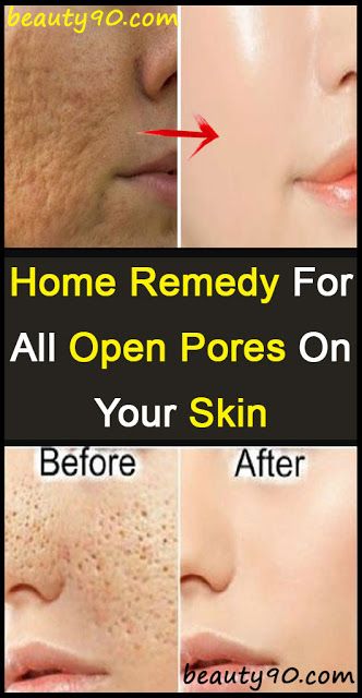 Performing a fast Cleanse to wash Pores and obtain obviate Clogged Pores