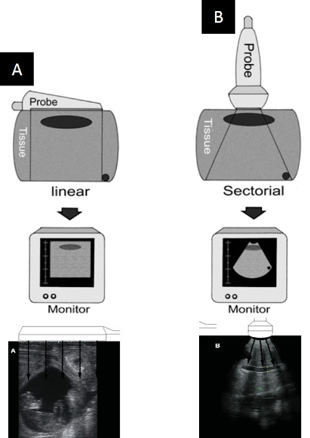 Ultrasonography (Usg) dan Aplikasinya Pada Pemeriksaan Organ Reproduksi ...