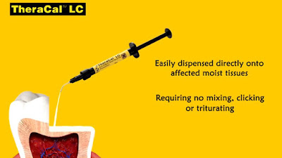 PULP CAPPING: TheraCal LC - Resin-Modified Calcium Silicate Pulp ...
