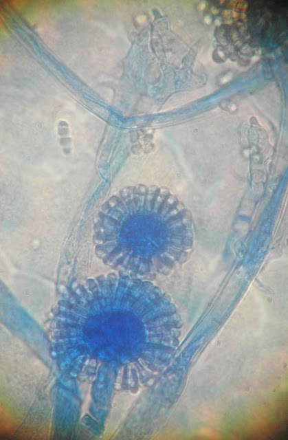 ATLAS MICOLOGIA: SYNCEPHALASTRUM RACEMOSUM