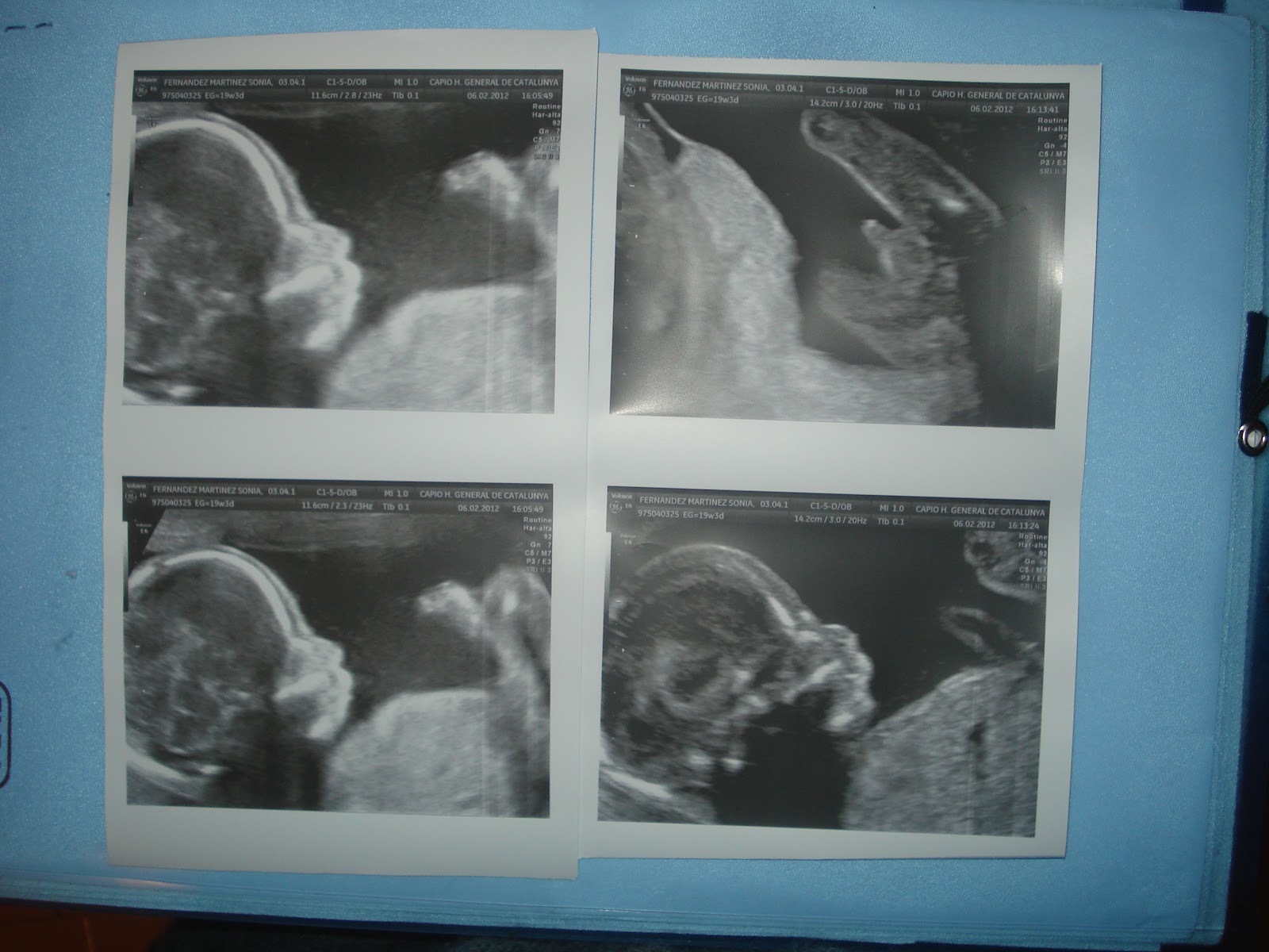 El comienzo de una vida: ECOGRAFIAS HASTA LAS 20 SEMANAS