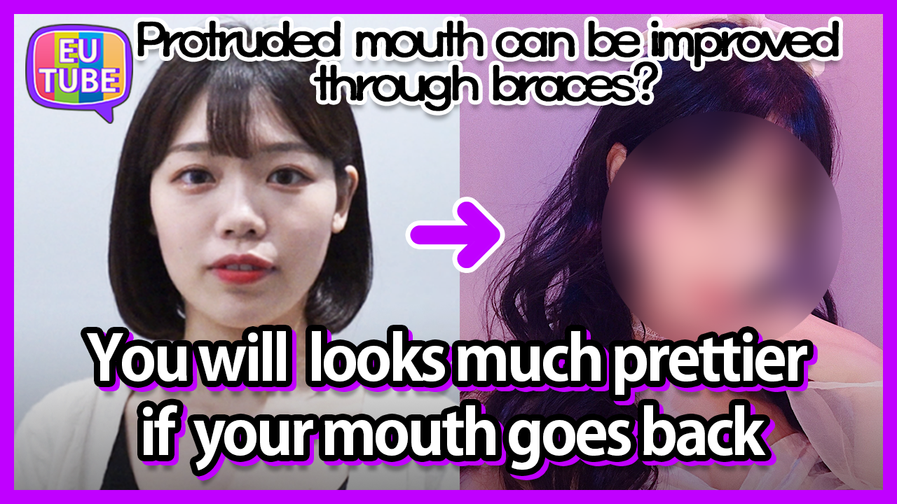 Anterior Segmental Osteotomy (ASO) Surgery _ EU