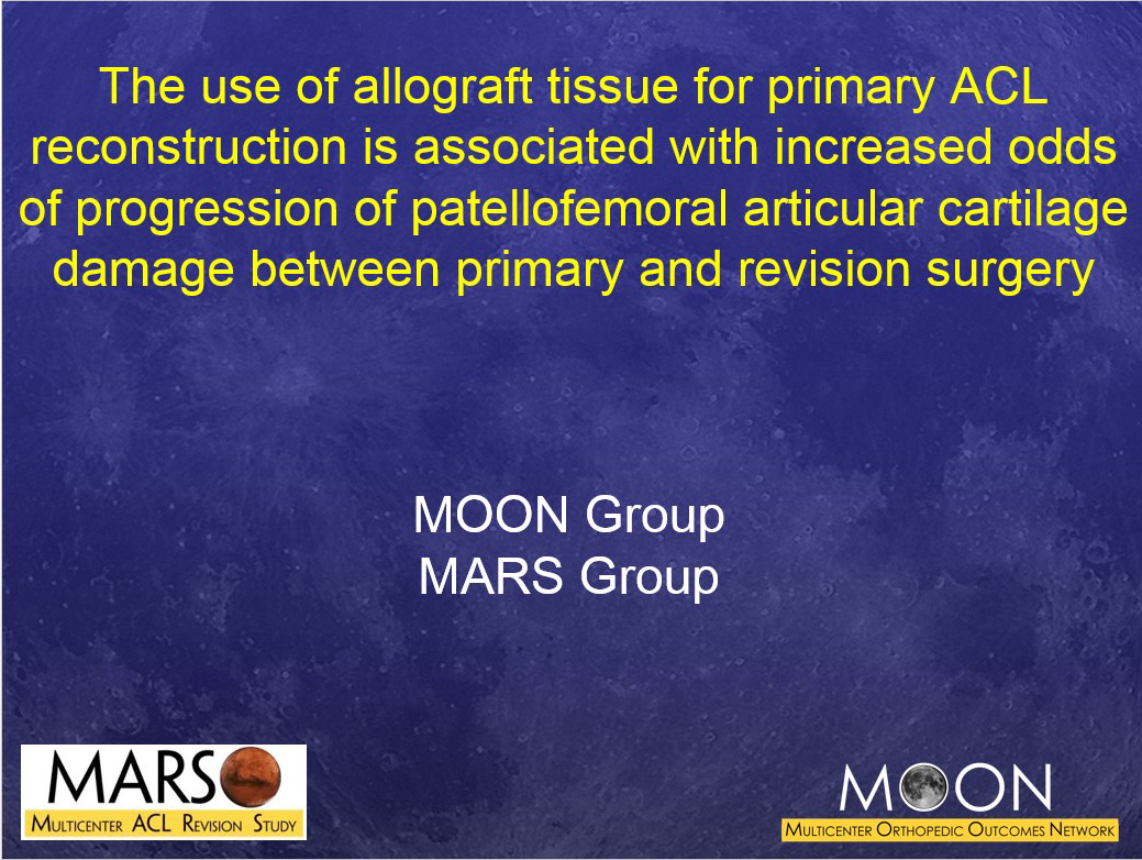 Sports and ACL Injuries: MOON-MARS Revision ACL Graft Study Presented ...