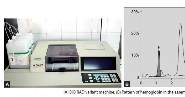 HPLC & Hb electrophoresis