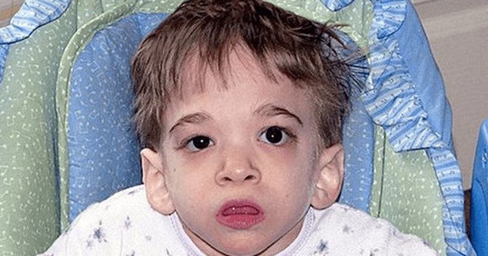 SYNDROME X ( Why aging wasn’t seen ?)