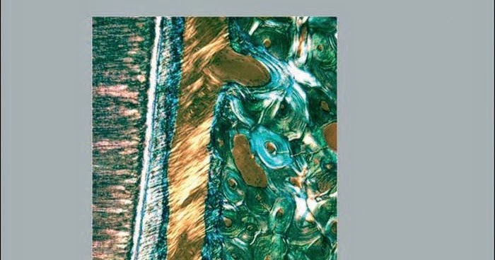 Clinical Periodontology and Implant Dentistry - Jan Lindhe,Niklaus P ...