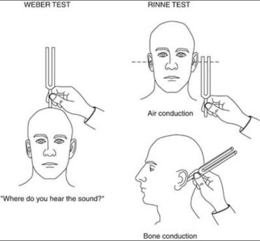 WEBER AND RINNE TEST | WEBER AND RINNE TEST EXPLAINED | WEBER TEST AND ...