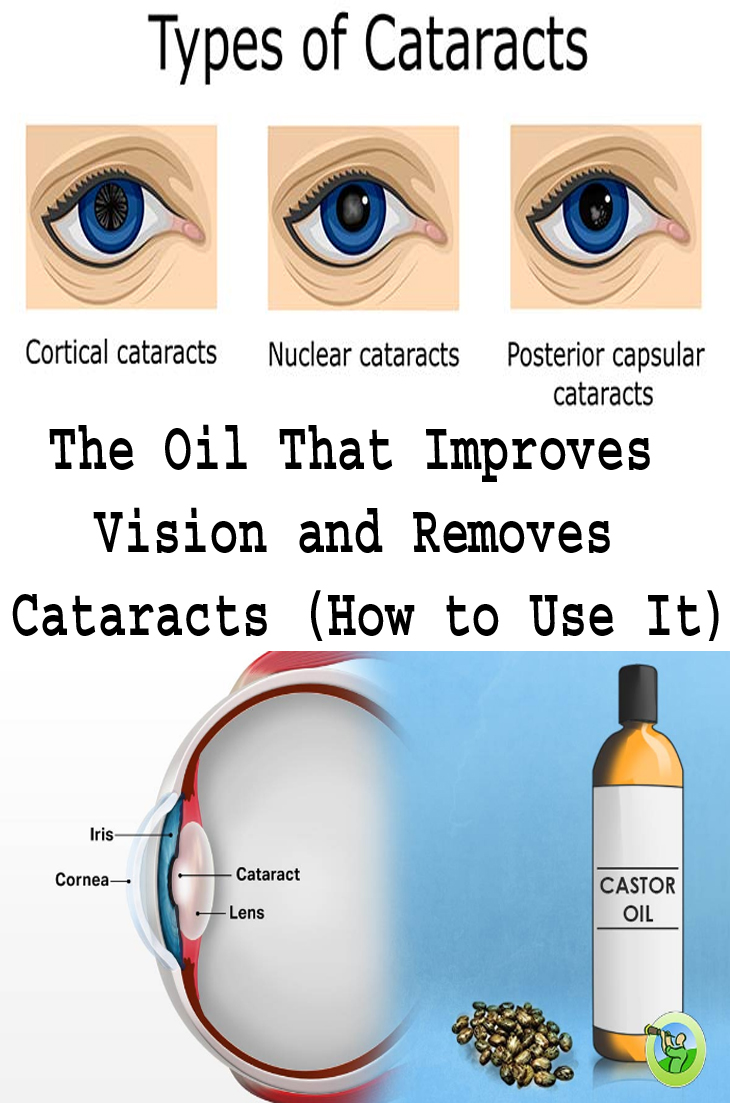 The Oil That Improves Vision and Removes Cataracts (How to Use It)