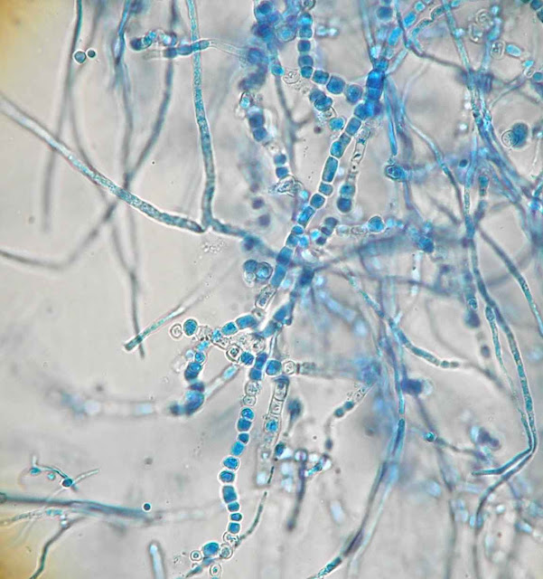 ATLAS MICOLOGIA: TRICHOPHYTON INTERDIGITALE