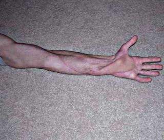 Roodepoort National and International: "Puff Adder Bite"