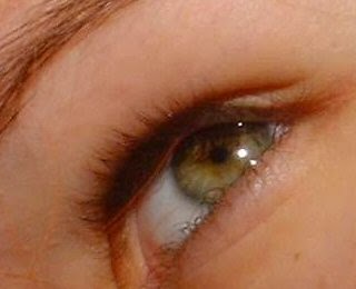 BenveNutri: Hipovitaminose A