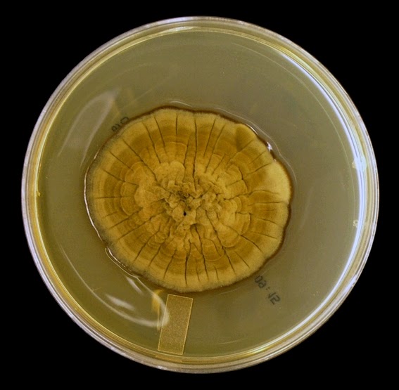 Fun With Microbiology (What's Buggin' You?): Ochroconis species