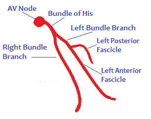 Bundle Branch Blocks Part 1