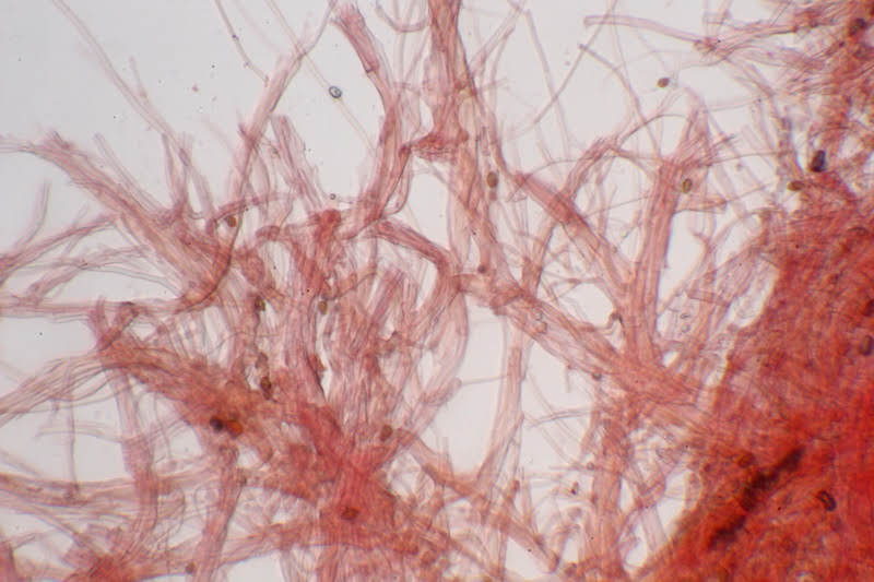 El mundo microscópico de los hongos: Phlebiopsis gigantea (Fr.)Jul.