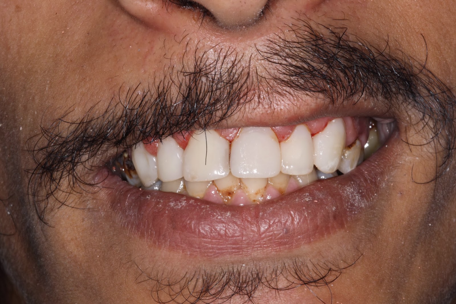 Crescent Dental on Blogspot!