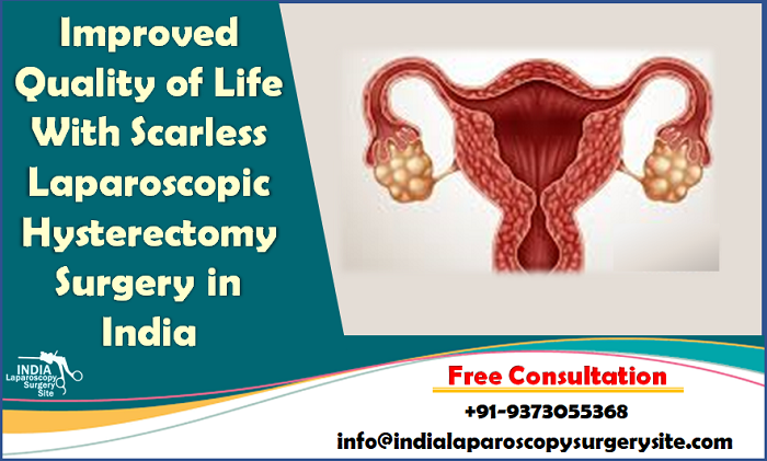 Improved Quality of Life With Scarless Laparoscopic Hysterectomy Surgery in India - India ...