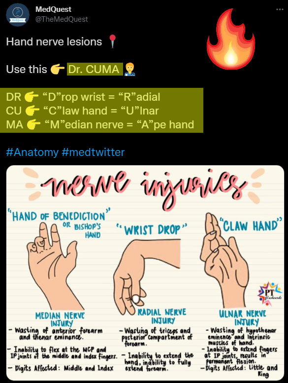 Nerve Injuries of the hand - Mnemonic