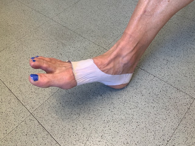 Foot and Ankle Problems By Dr. Richard Blake: Plantar Fasciitis ...