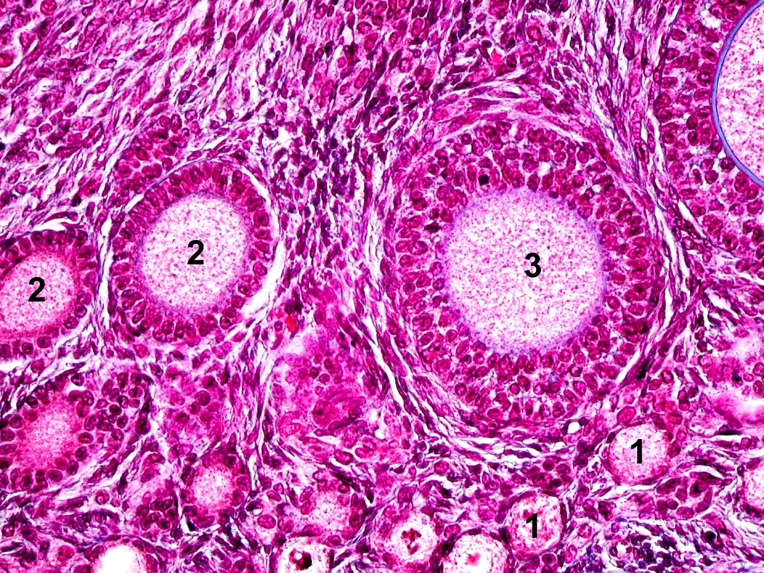 SOS BIOLOGIA CELULAR Y TISULAR: GENITAL FEMENINO. OVARIO. IDENTIFICA ...