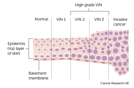 Radiotherapy Dictionary: July 2019