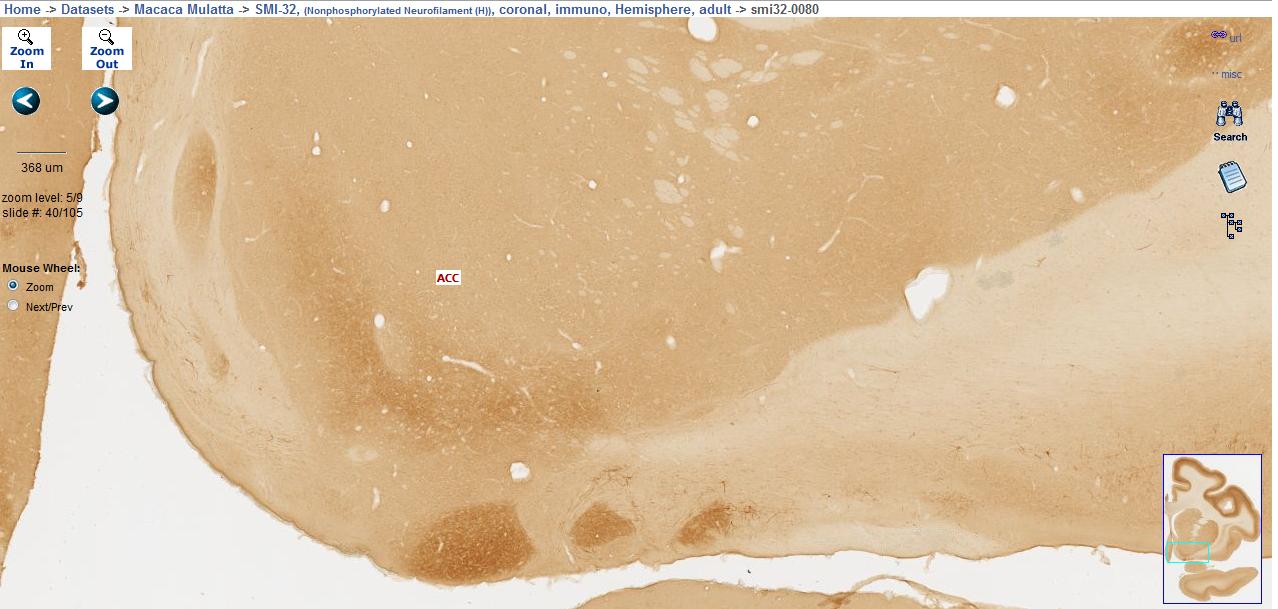 Sides of sentience: Pleasure centers (septal nuclei, nucleus accumbens ...