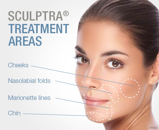 Sculptra - the ultimate Face Liquid Lift