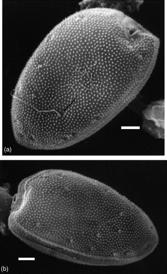 Sciency Thoughts: Assessing how blooms of the Dinoflagellate ...