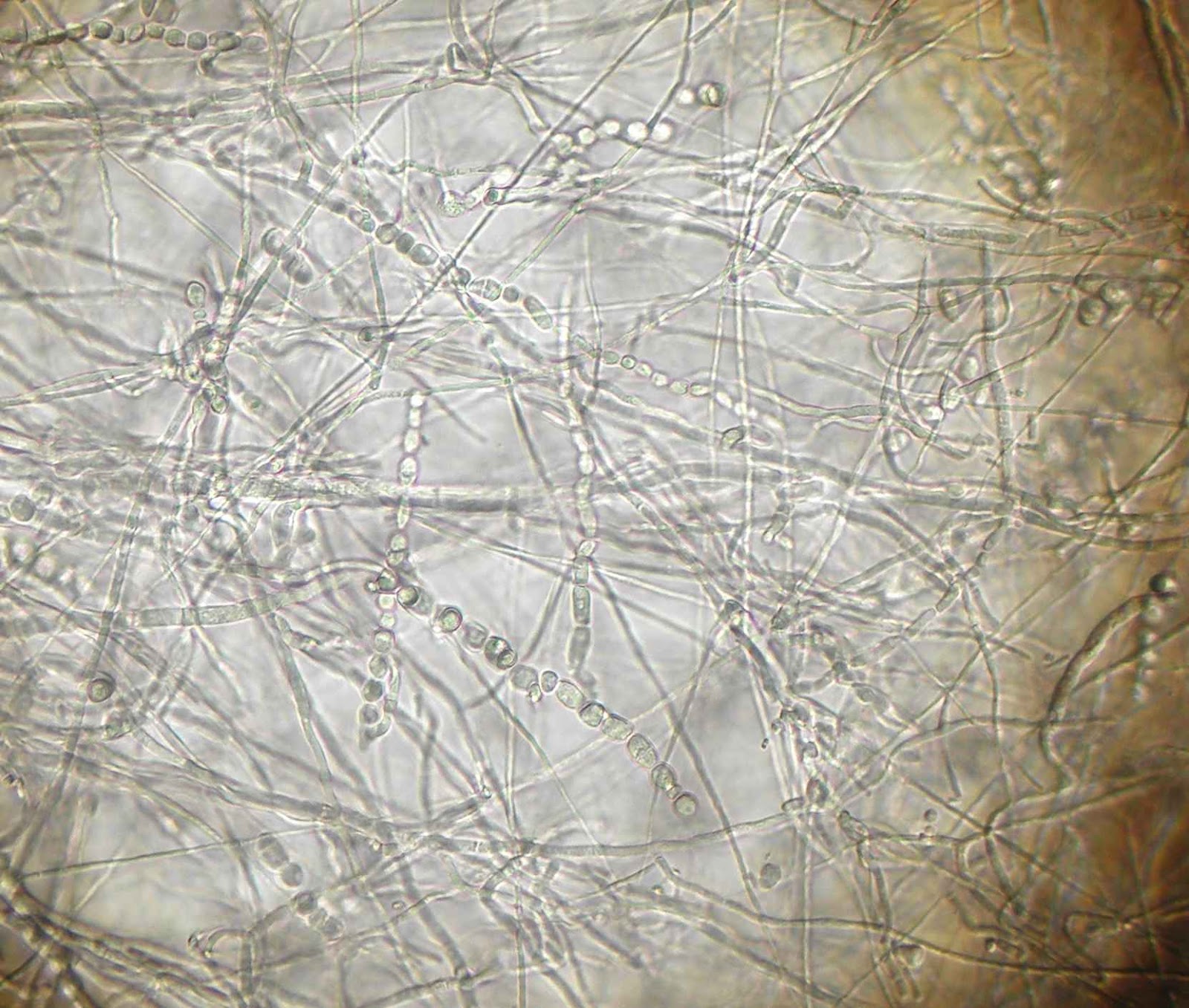 ATLAS MICOLOGIA: SCYTALIDIUM DIMIDIATUM (Neoscytalidium dimidiatum)