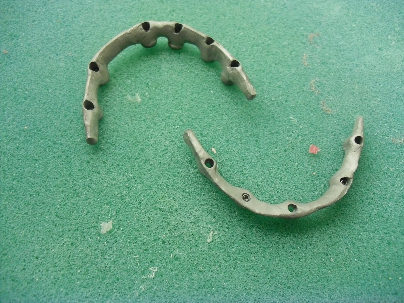 J.M Prótese Dentária: protocolo superior e inferior , carga imediata.