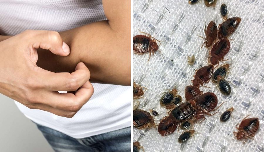 Petua Hilangkan Gatal Kutu - Tips Petuah