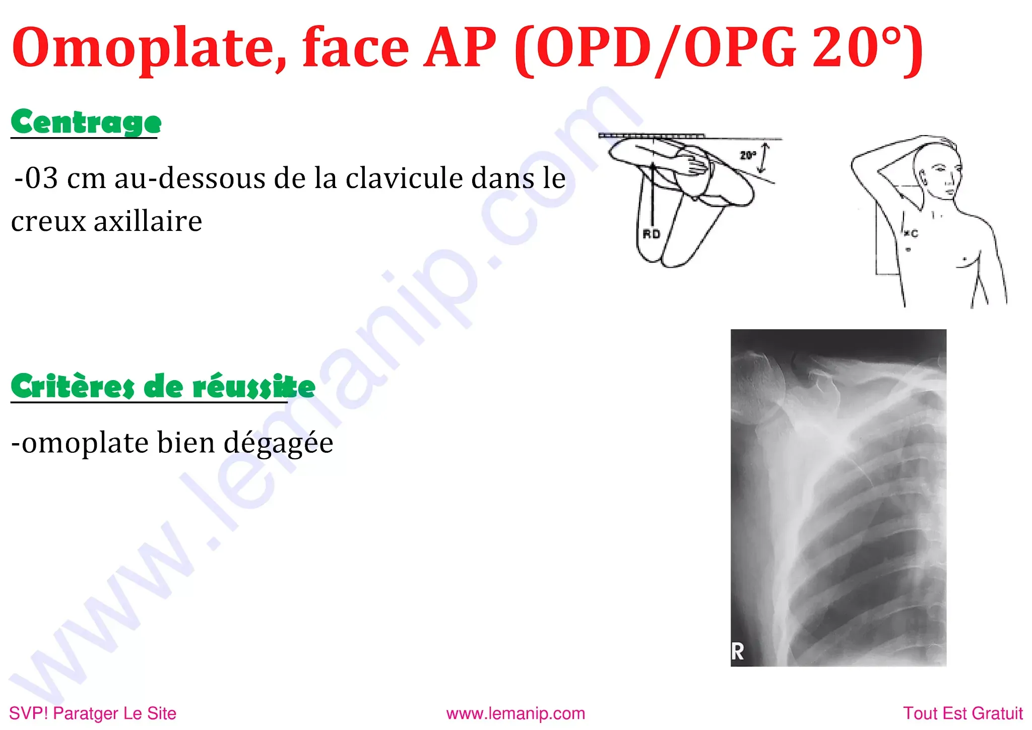 Incidences Radiologique Et Constantes Et Critères De Réussite PDF