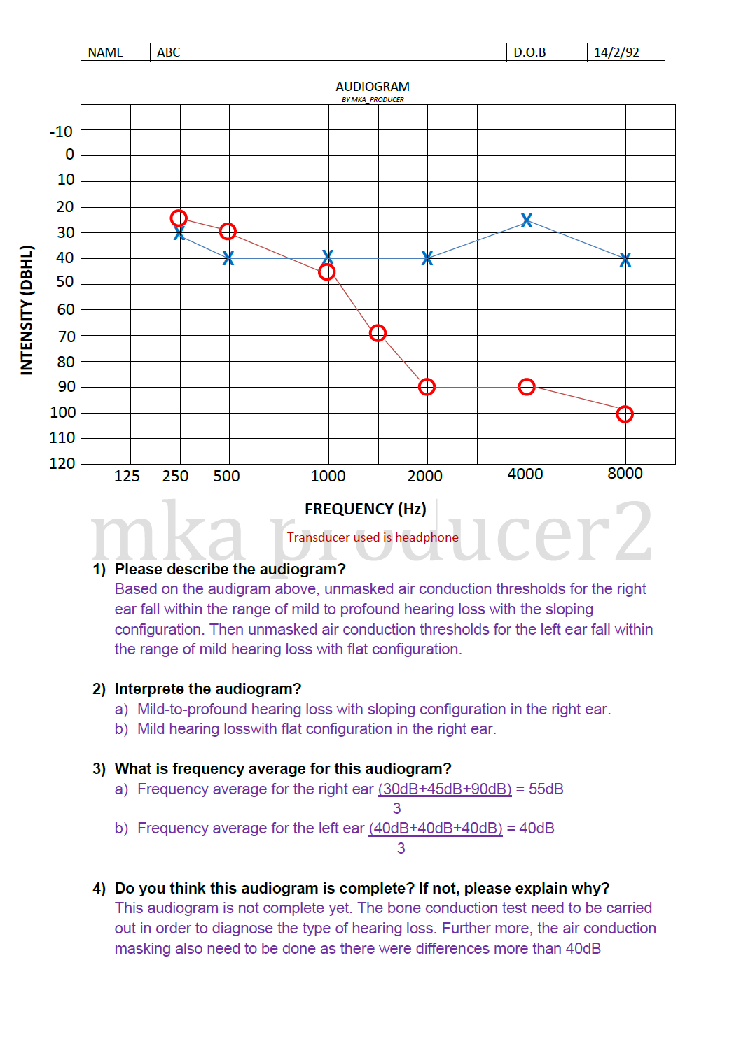 AUDIOGRAM WORKSHEET 2 | AUDIOLOGIS