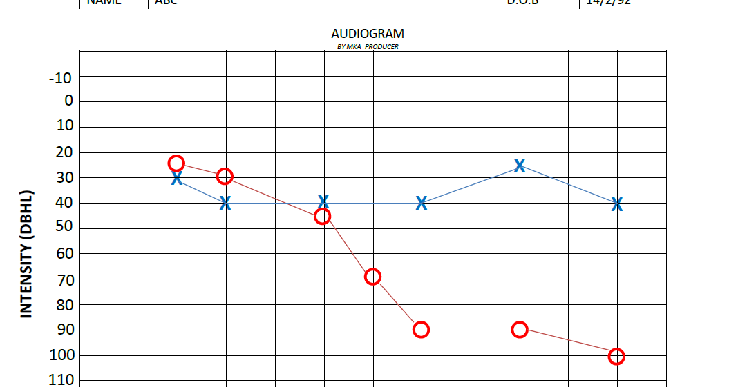 AUDIOGRAM WORKSHEET 2 | AUDIOLOGIS