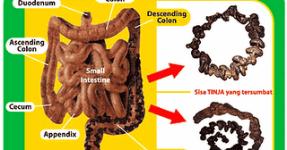 Bahaya Toksin Dalam Tubuh ~ BEKAM BINTAN THERAPY