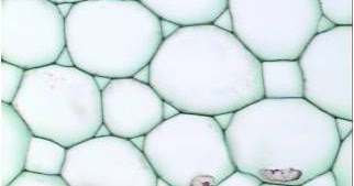 Parenchyma: Different types, Structure and Function | Plant Science 4 U