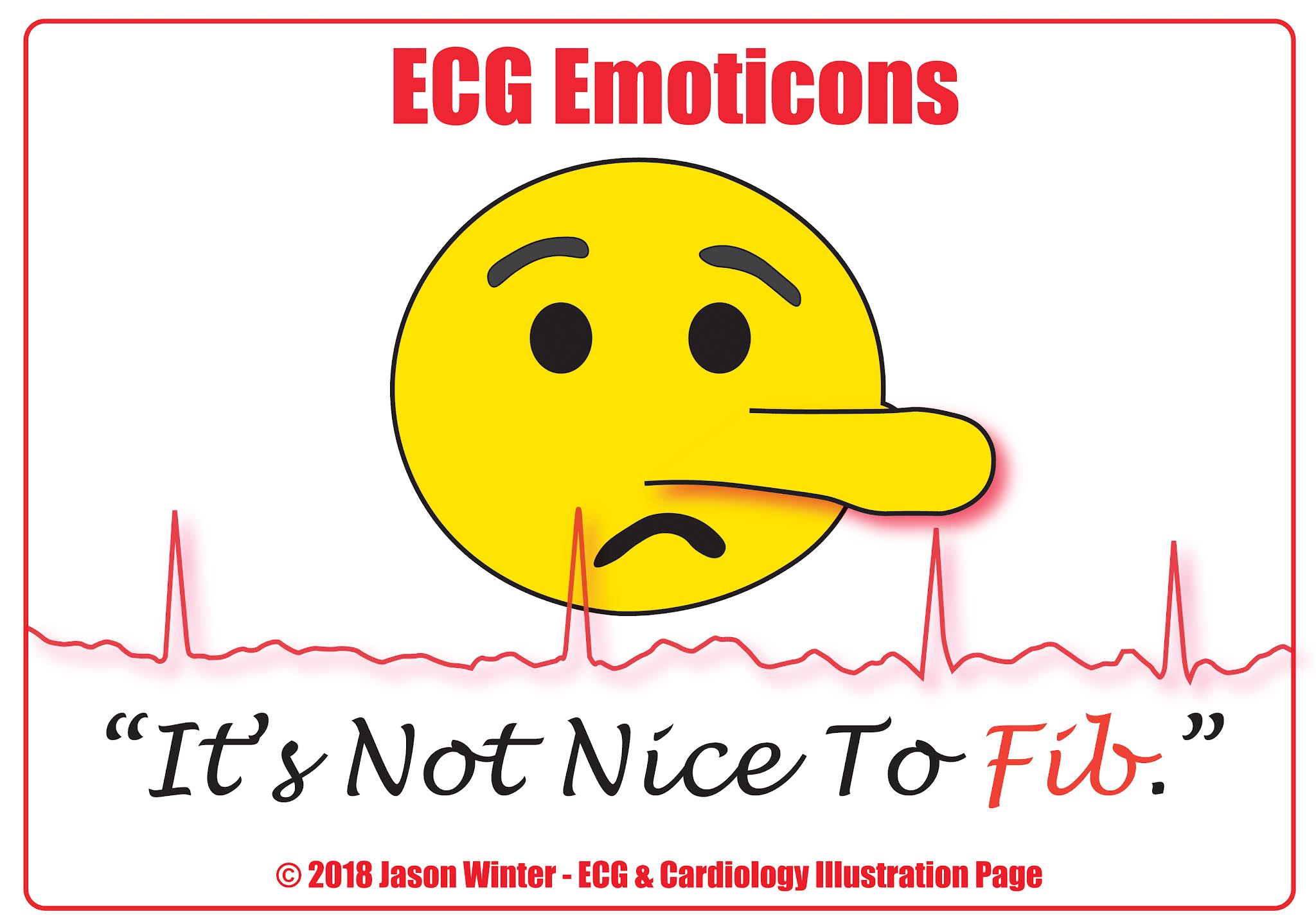 ECG Educator Blog : ECG humour cards