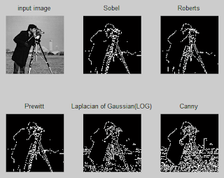 Image Processing using Matlab: Edge Detection