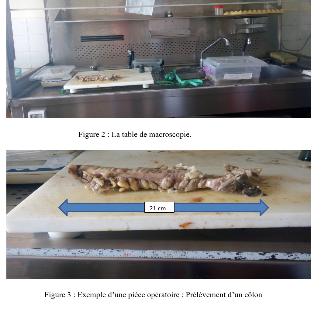 La macroscopie en anapath