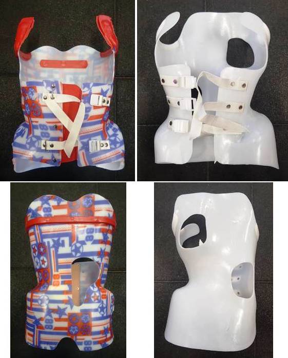 Despre corsetul Cheneau :: Corset scolioza / scoliosis braces