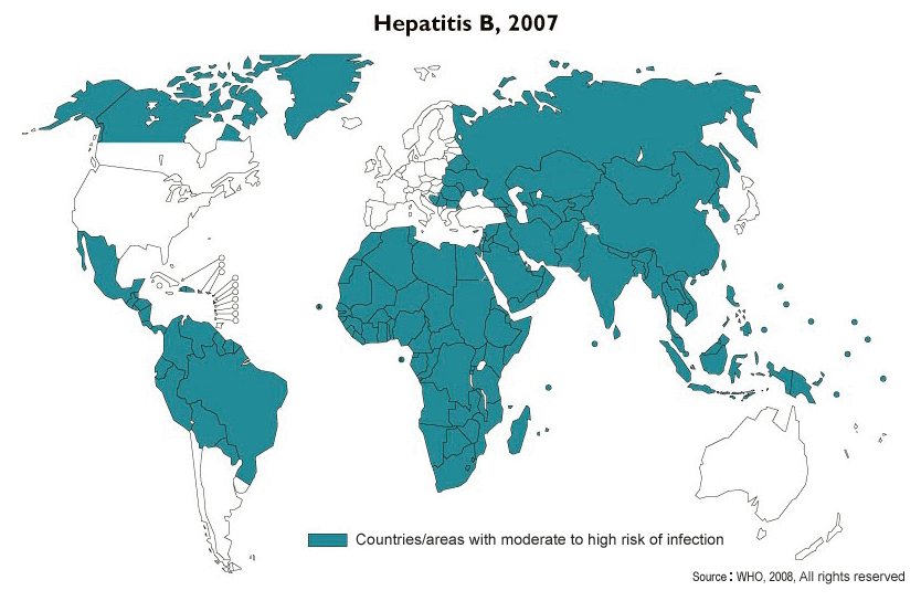 All About Hepatits B: Statistics of Hepatitis B