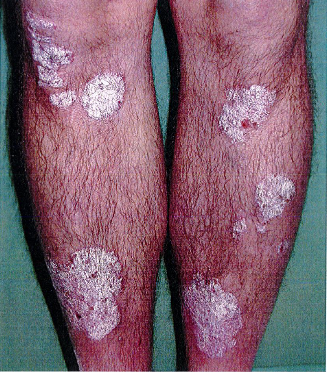 Dermapixel: febrero 2018