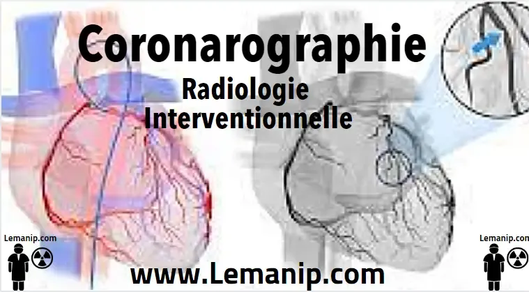 Coronarographie
