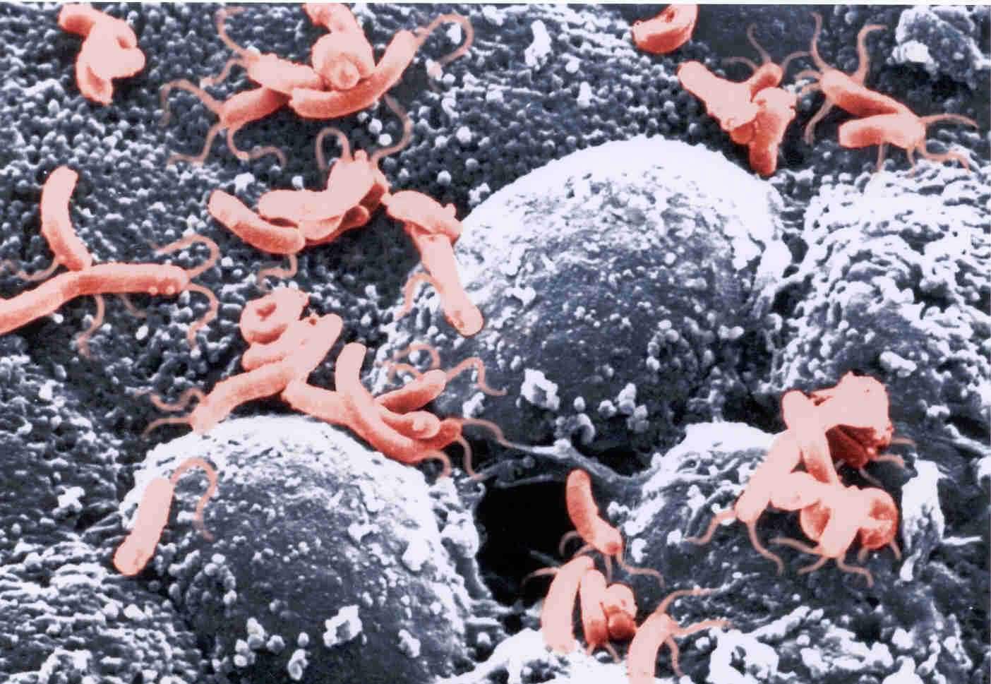Determinacion de Helicobacter pylori.