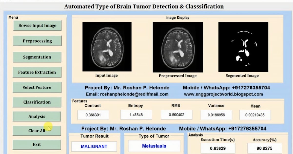 Types Of Brain Tumor Detection Using Matlab Project Source Code