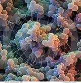 Bakteri Staphylococcus aureus | Informasi Kesling